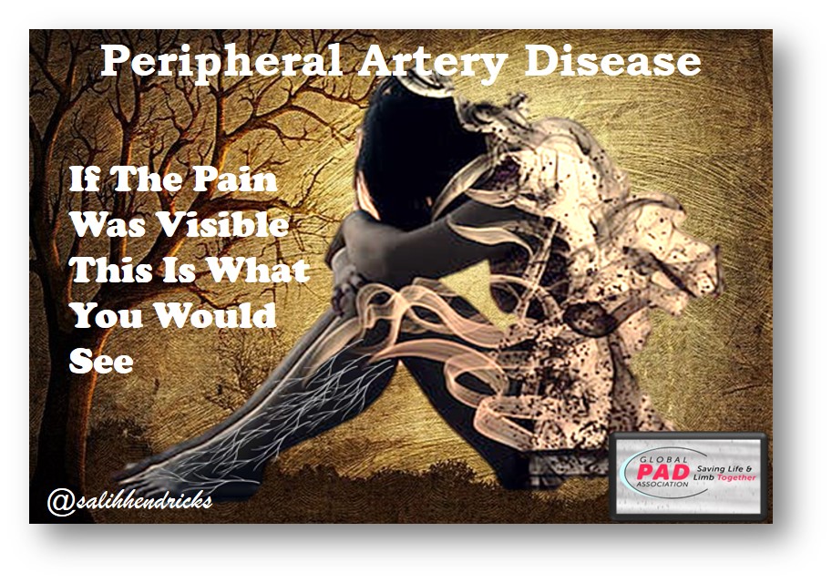 If PAD Pain Was Visible…What Would You See? – PAD: The Lived Experience